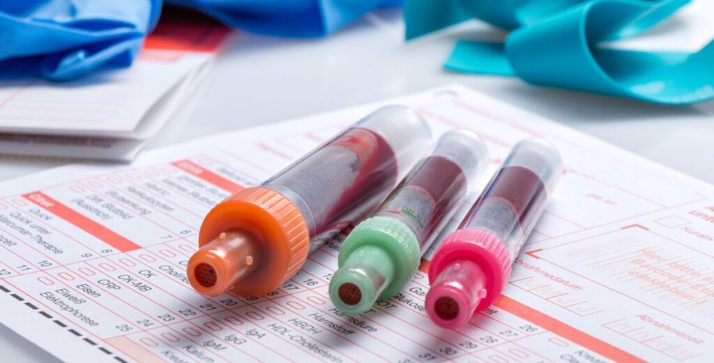 Die Top 5 Blutwerte und ihre Bedeutung | Sierks Media